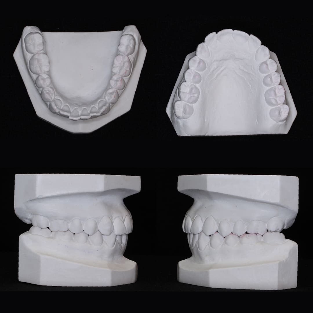 Modelos Dentales - Radiológico Oral Star RX