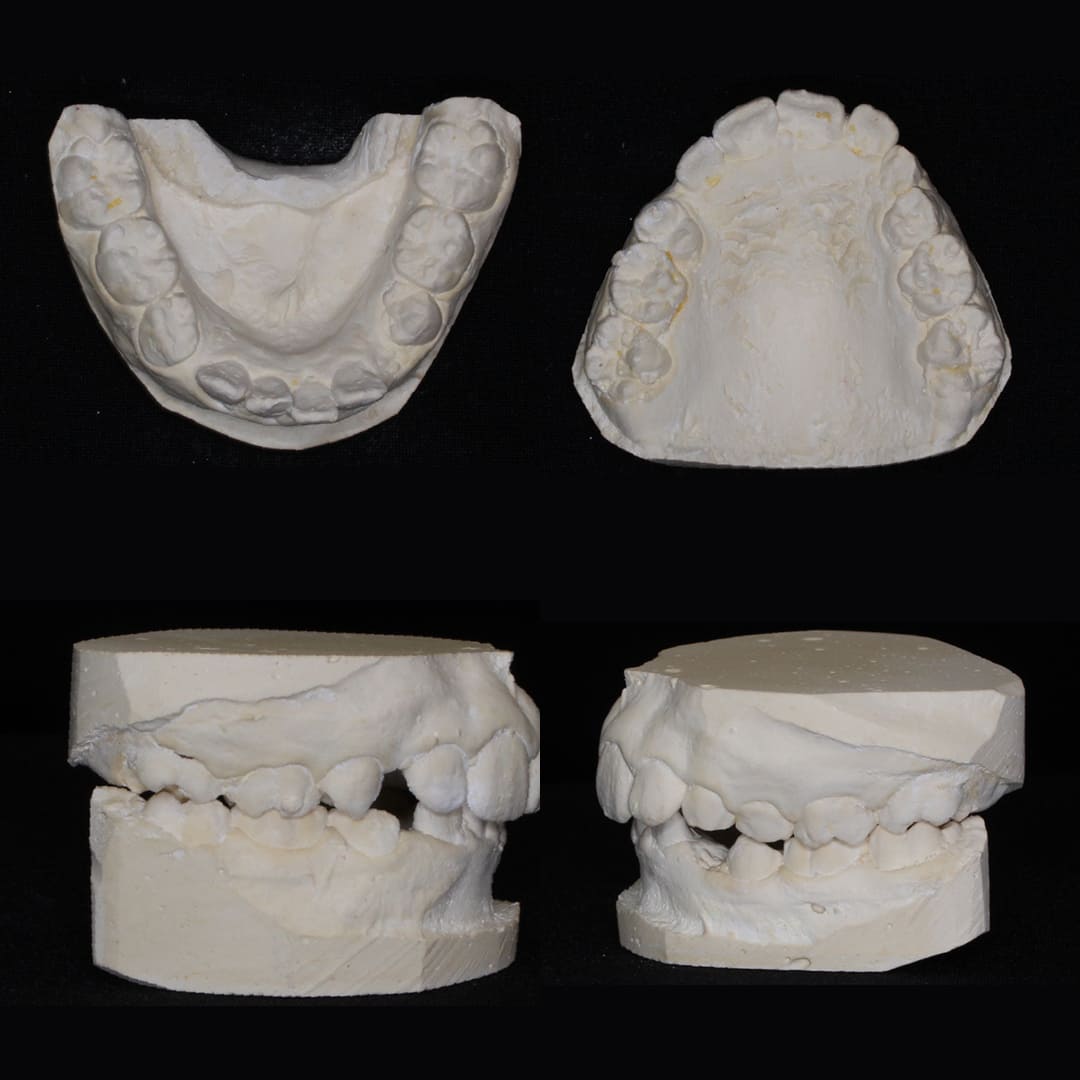 Modelos Dentales - Radiológico Oral Star RX